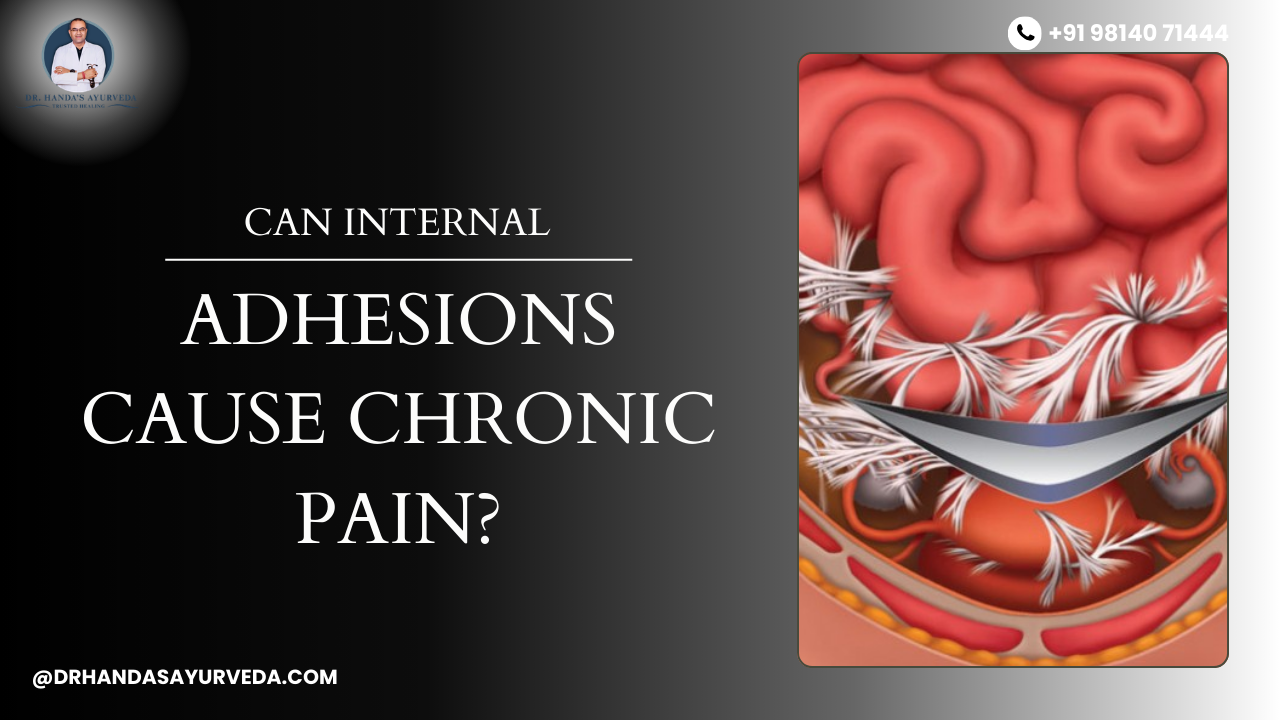 Can Internal Adhesions Cause Chronic Pain?